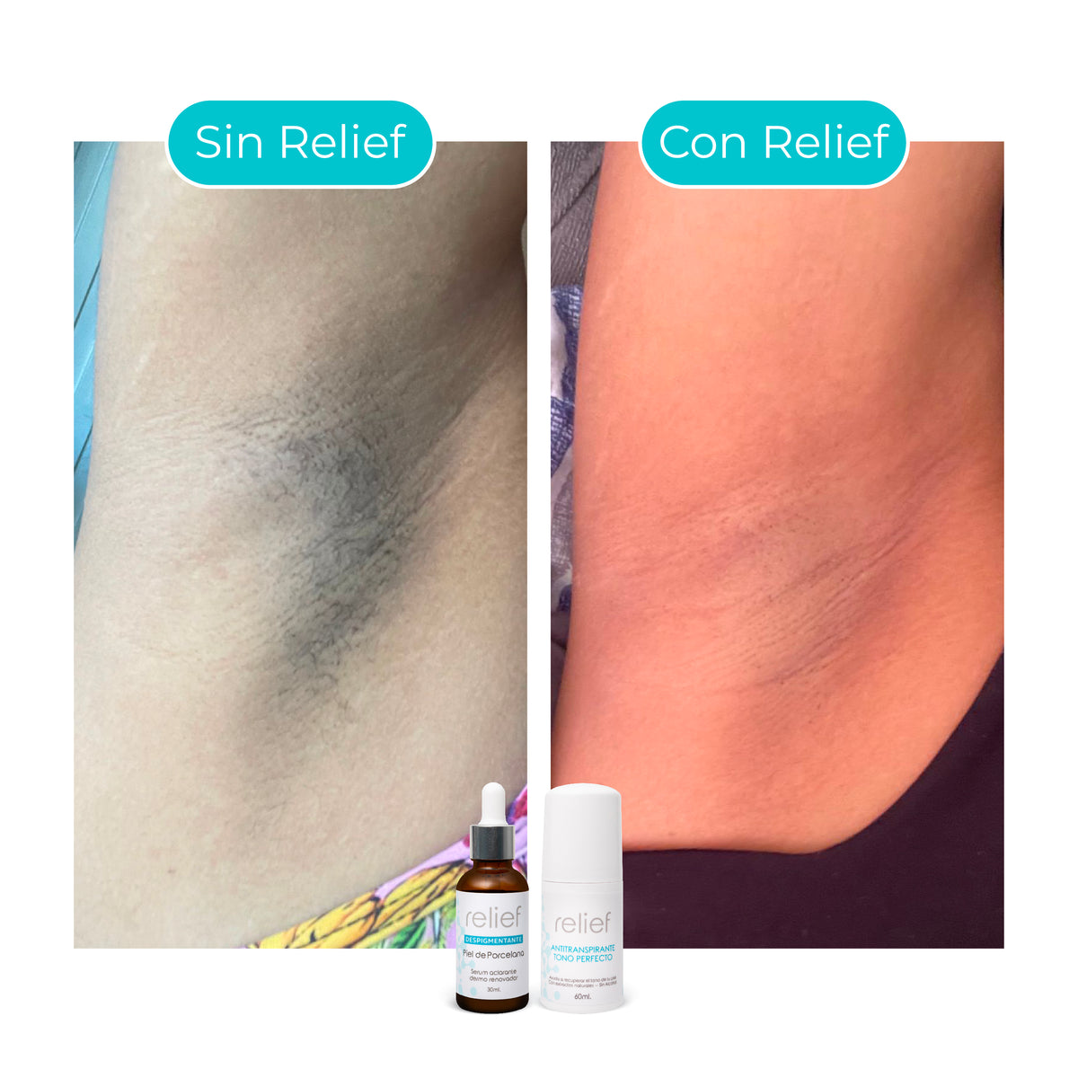 KIT ACLARANTE DE AXILAS: Despigmentante de piel y antitranspirante – Relief